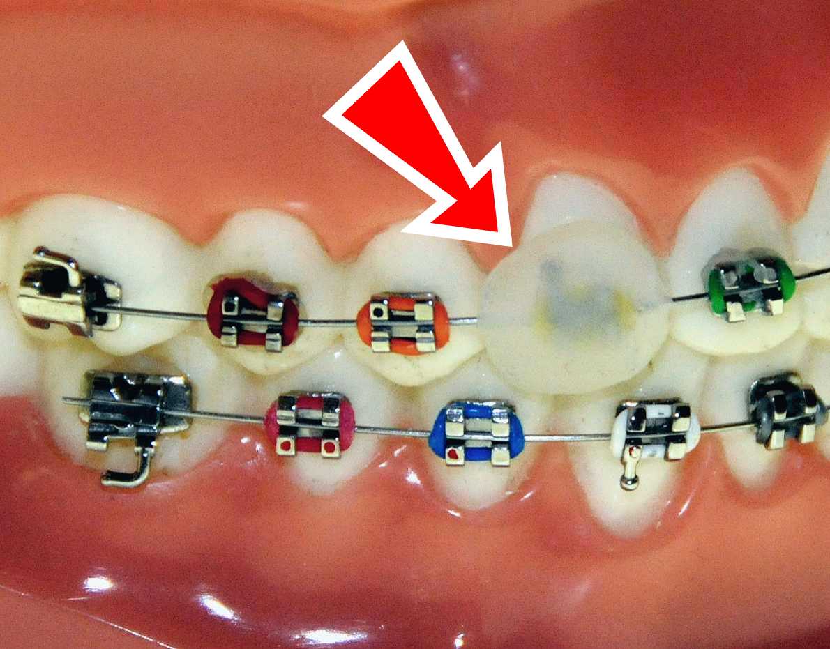 Emergency Care - Barton Orthodontics | Modesto CA